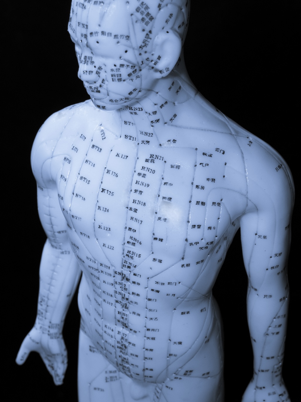Acupuncture – Conwy Physio Clinic